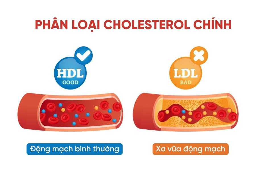 Tạm Biệt Cholesterol Cao: Giải Pháp Tự Nhiên Cho Trái Tim Khỏe Mạnh! - Bác Sĩ Mai Hoa